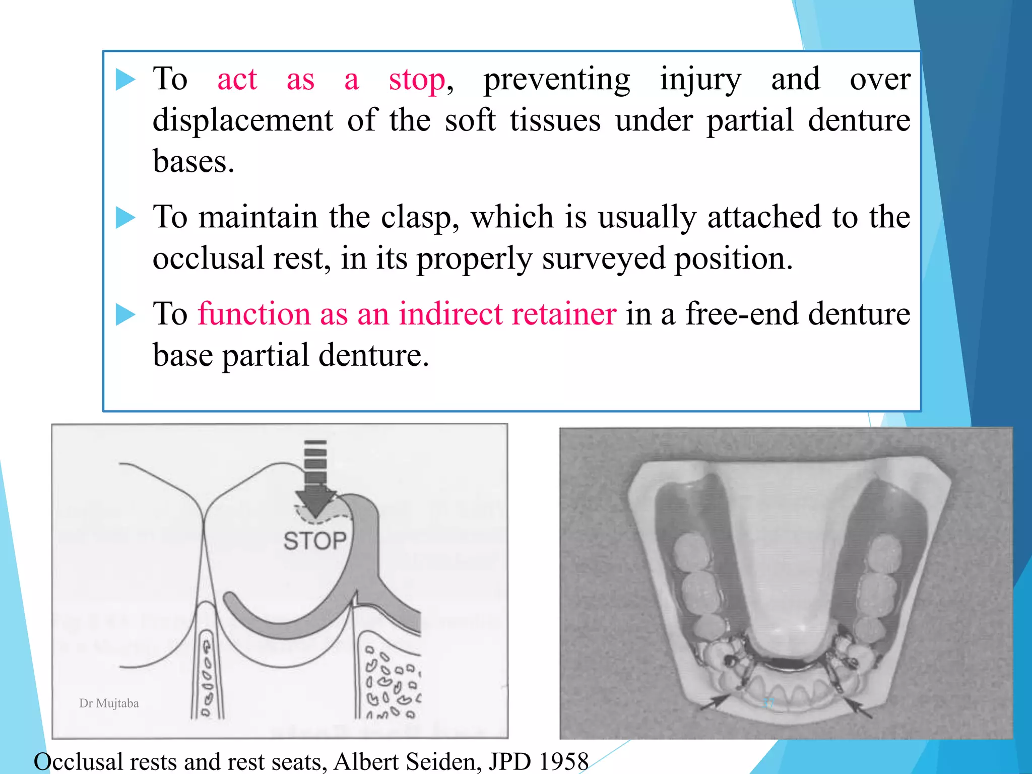 Minor connectors, rests & rests seats In prosthodontics | PPTX