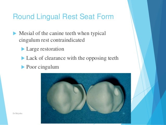 Minor connectors, rests & rests seats In prosthodontics