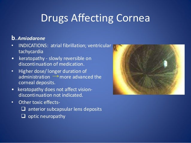 Systemic drugs affecting cornea