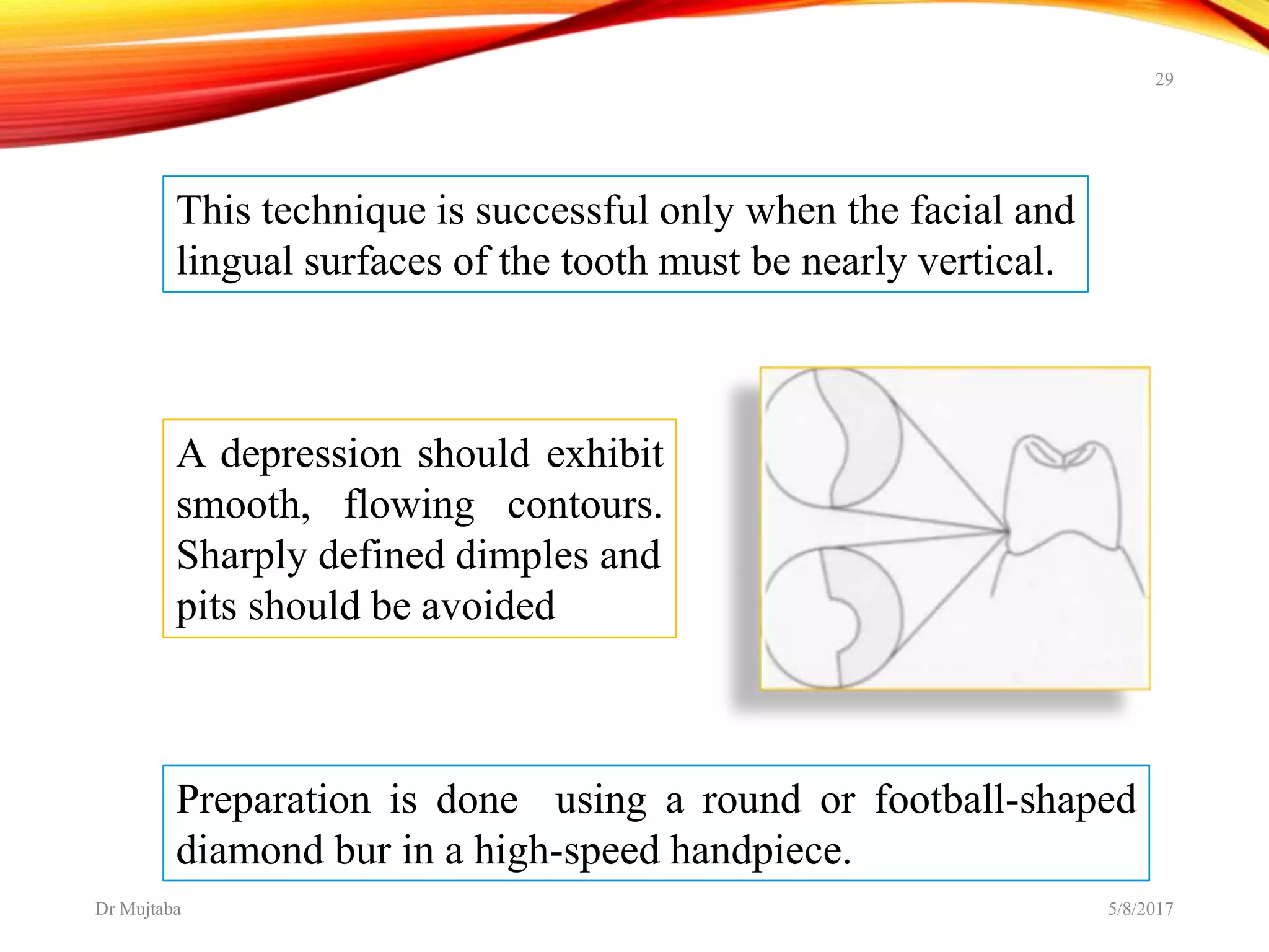 Mouth preparation for Removable dental prosthesis | PPTX