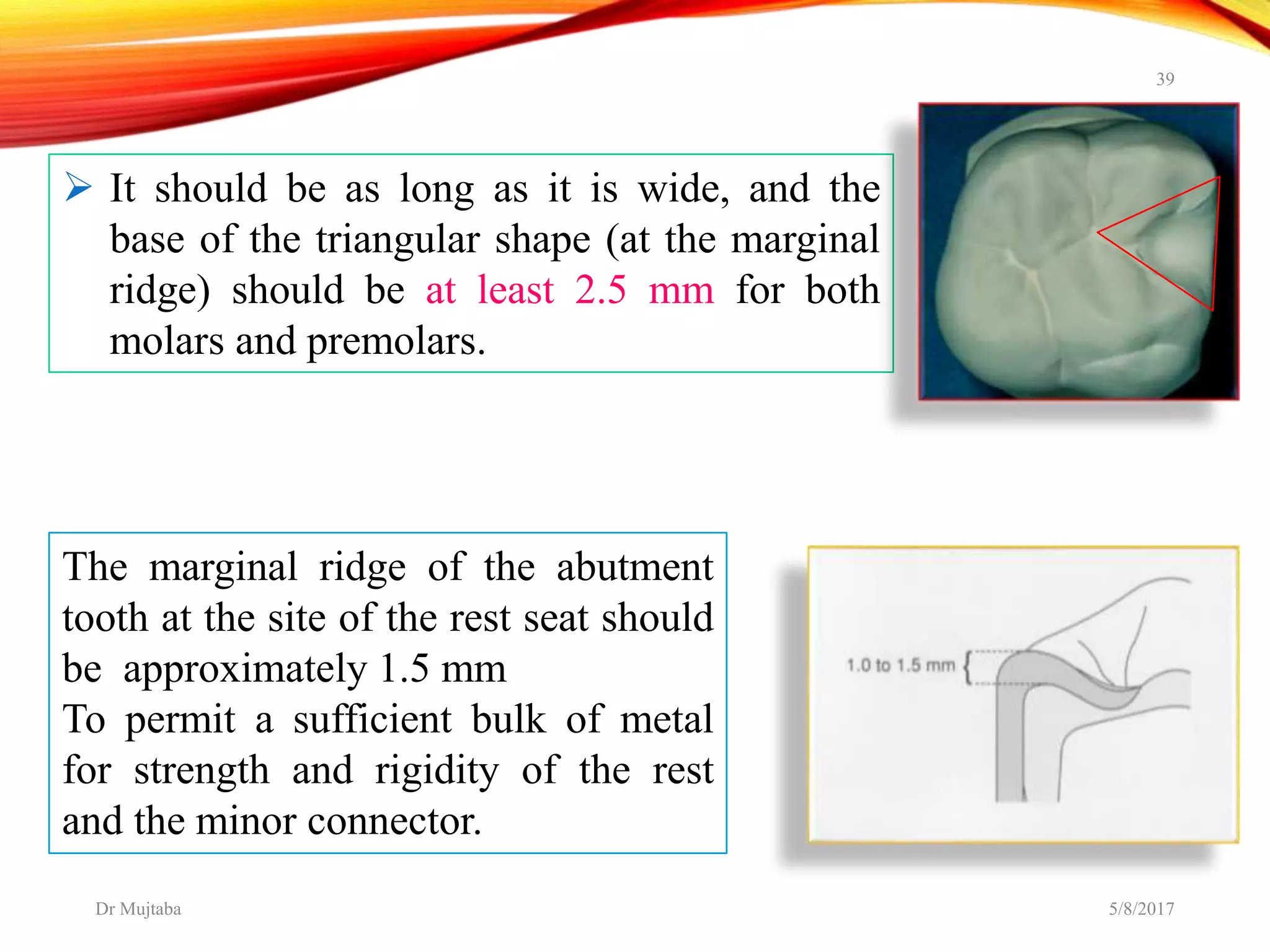 Mouth preparation for Removable dental prosthesis | PPTX