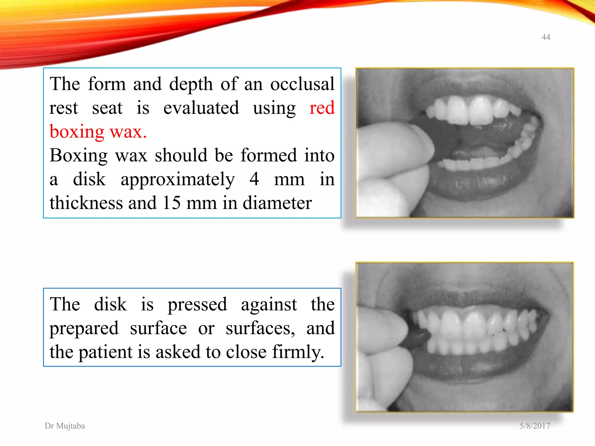 Mouth preparation for Removable dental prosthesis | PPTX