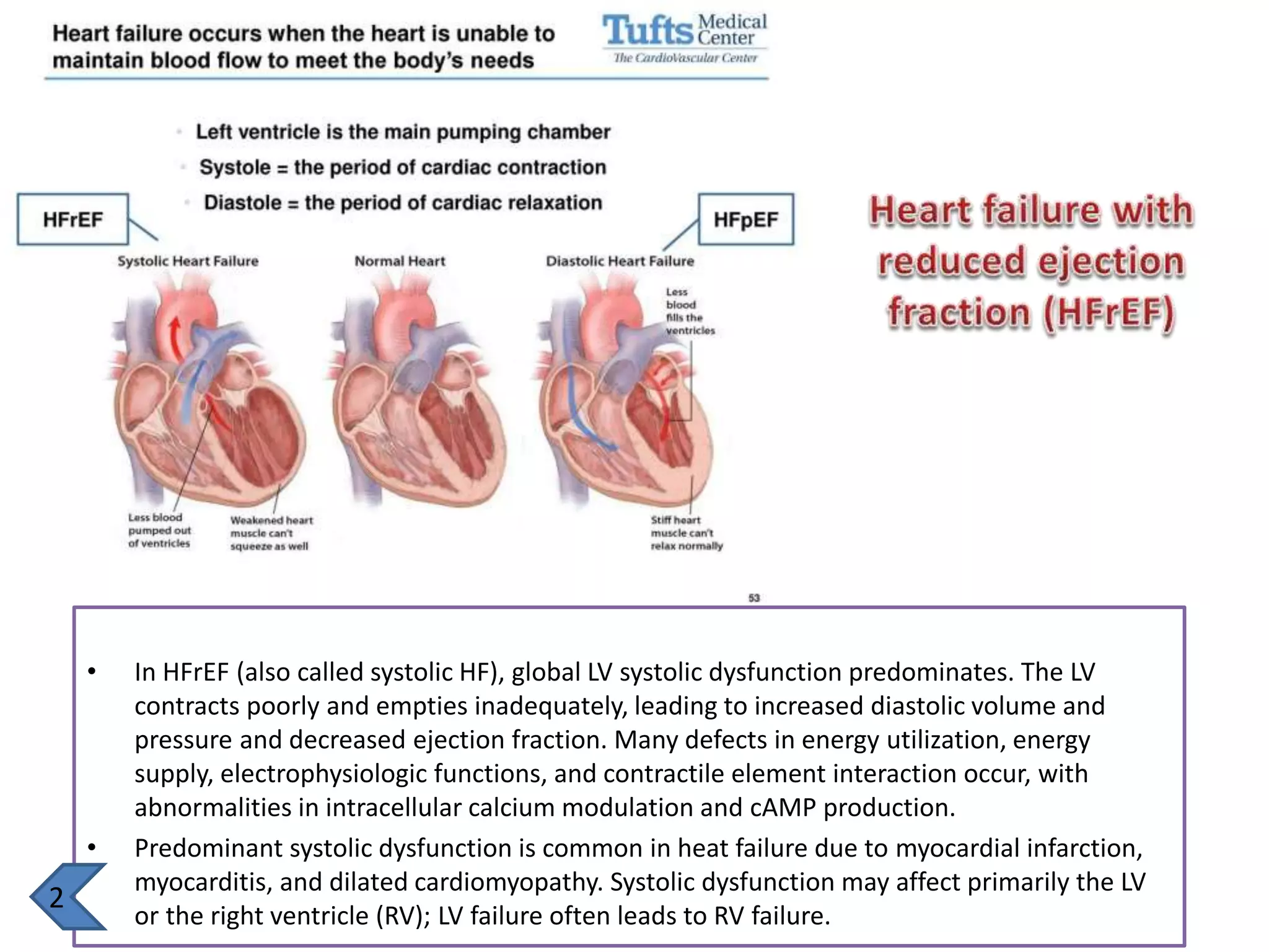 Pathophysiology of "Heart failure" | PPTX