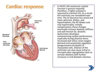 Pathophysiology of "Heart failure" | PPTX