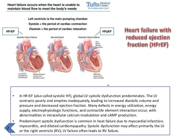 Pathophysiology of "Heart failure"