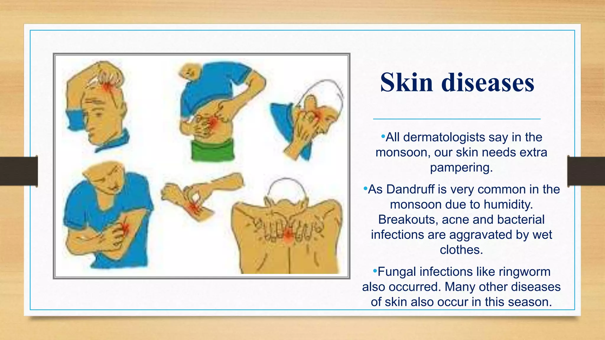 A Questionnaire Base Study On VBDs & Seasonal Diseases in Public In ...