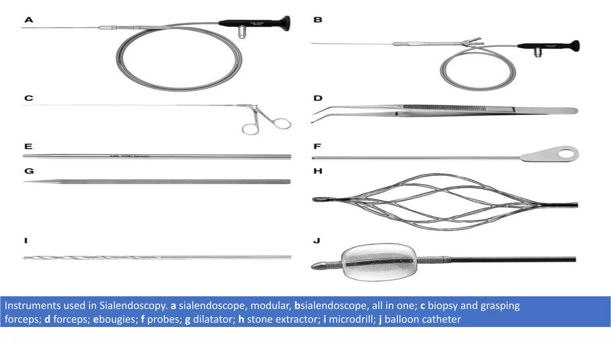 Sialendoscopy | PPTX