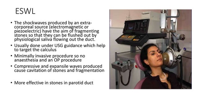 Sialendoscopy | PPTX | Ear, Nose and Throat Conditions | Diseases and ...