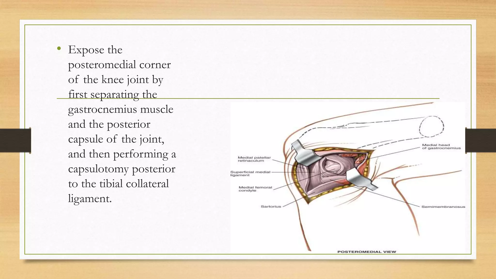 SURGICAL APPROACHES TO KNEE JOINT | PPTX