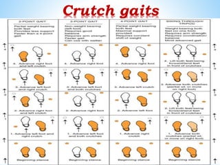 CRUTCH WALKING | PPT