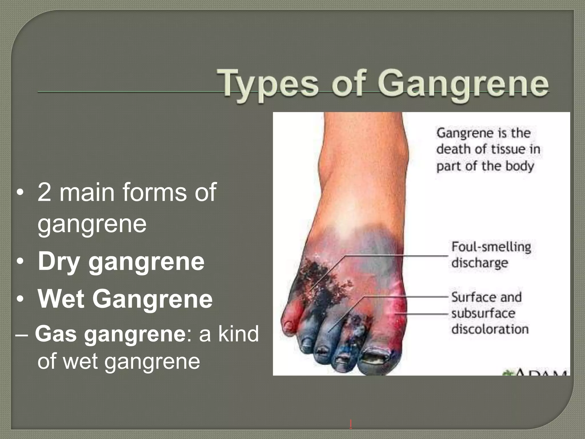 Gangrene | PPTX