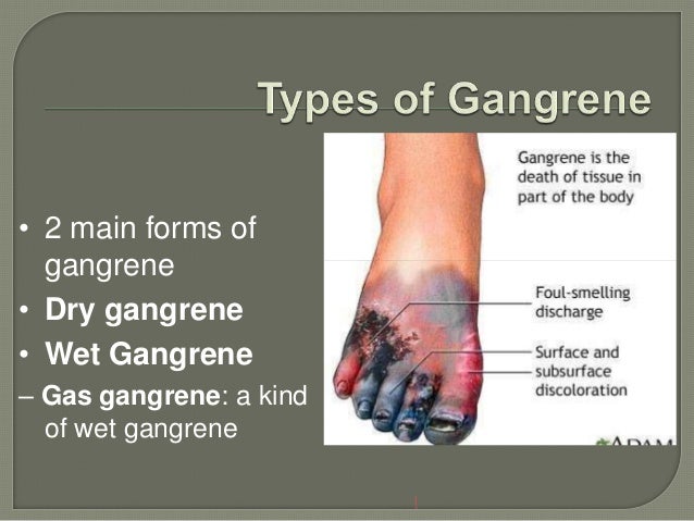 Gangrene
