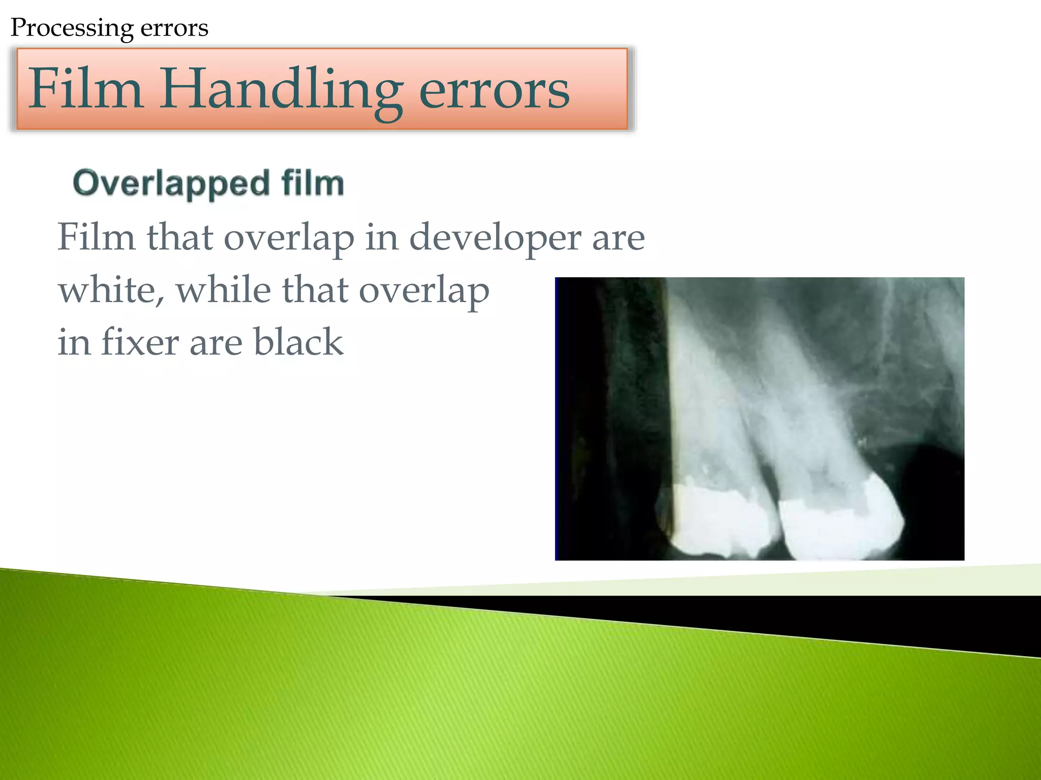 radiographic errors and artifacts | PPTX