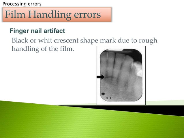 radiographic errors and artifacts | PPTX | Photo Editing Software | Computer Software and ...