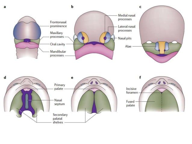 Development of Face and Palate including Anomalies of palate | PPTX