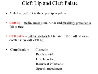 Development of Face and Palate including Anomalies of palate | PPTX