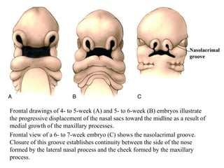 Development of Face and Palate including Anomalies of palate | PPTX