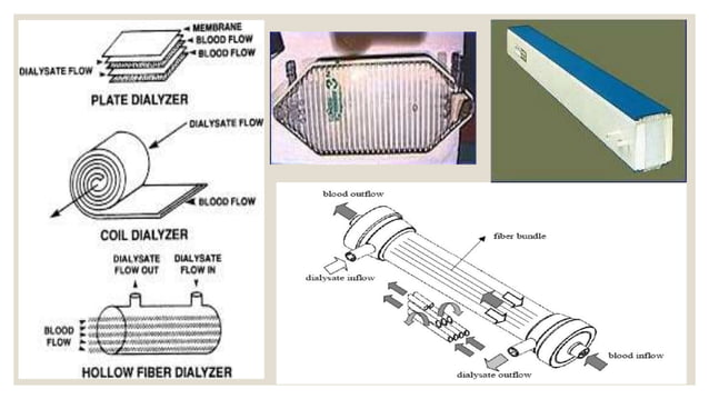 DIALYZER | PPTX | Blood Disorders | Diseases and Conditions