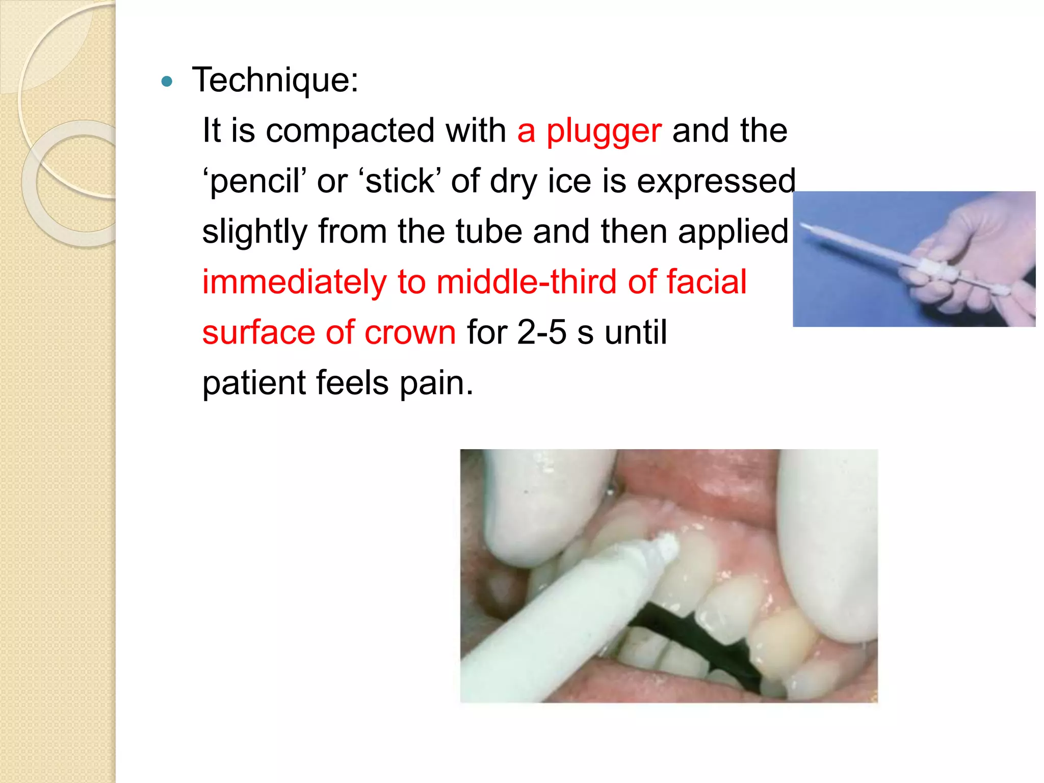 Assessment of pulp vitality | PPTX
