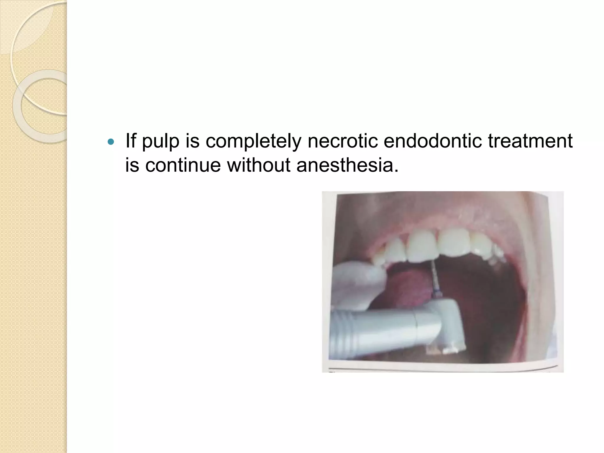Assessment of pulp vitality | PPTX