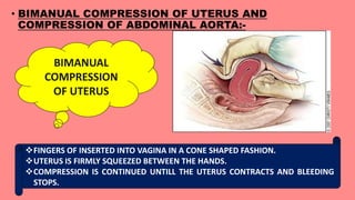 PPH MANAGEMENT DRILL | PPT