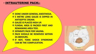 PPH MANAGEMENT DRILL | PPTX