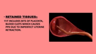 PPH MANAGEMENT DRILL | PPTX