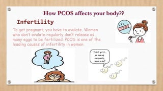 PCOS/PCOD (polycystic ovarian syndrome/polycystic ovary disease) | PPTX