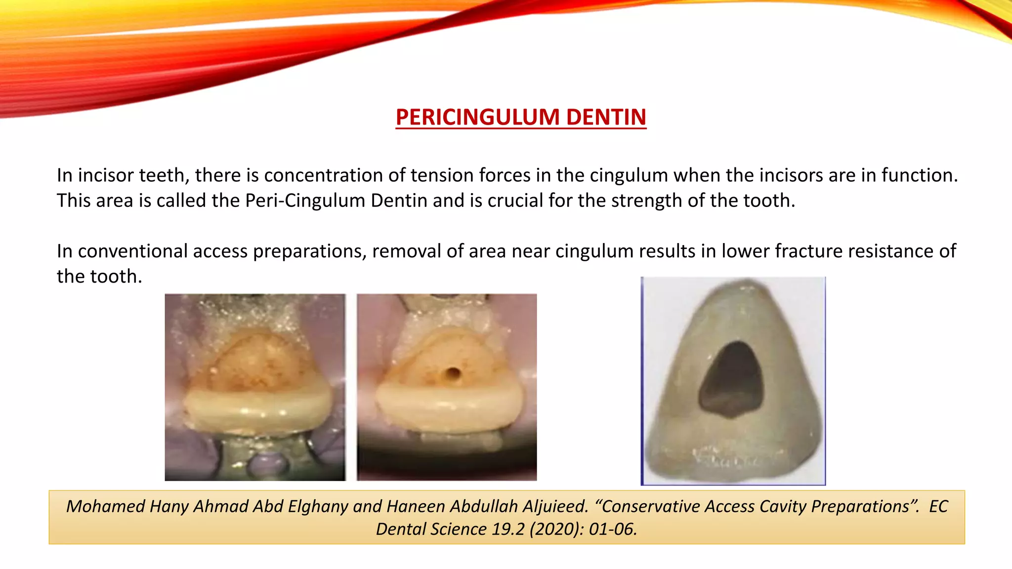 Minimal Invasive Endodontics | PPTX