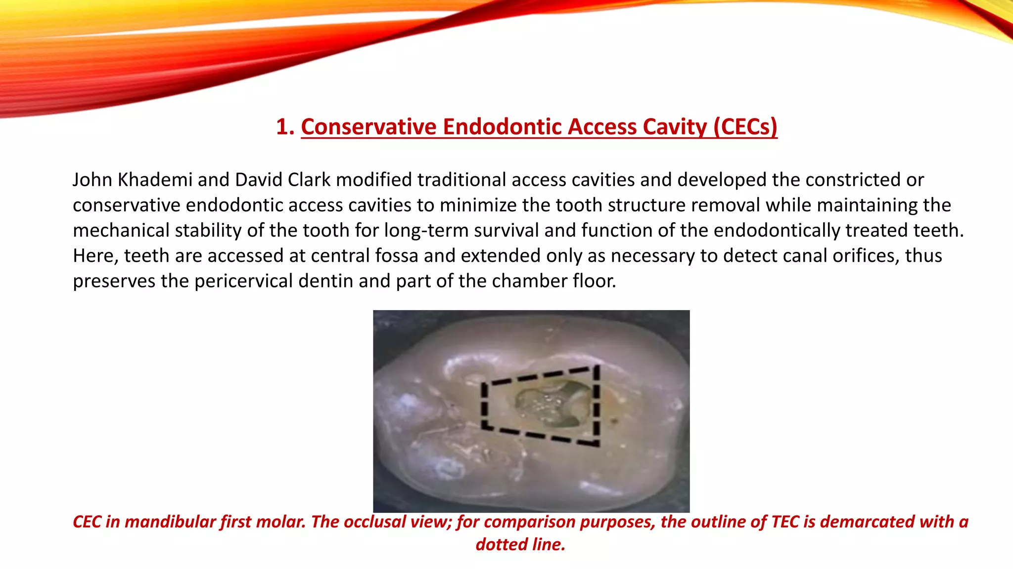 Minimal Invasive Endodontics | PPTX