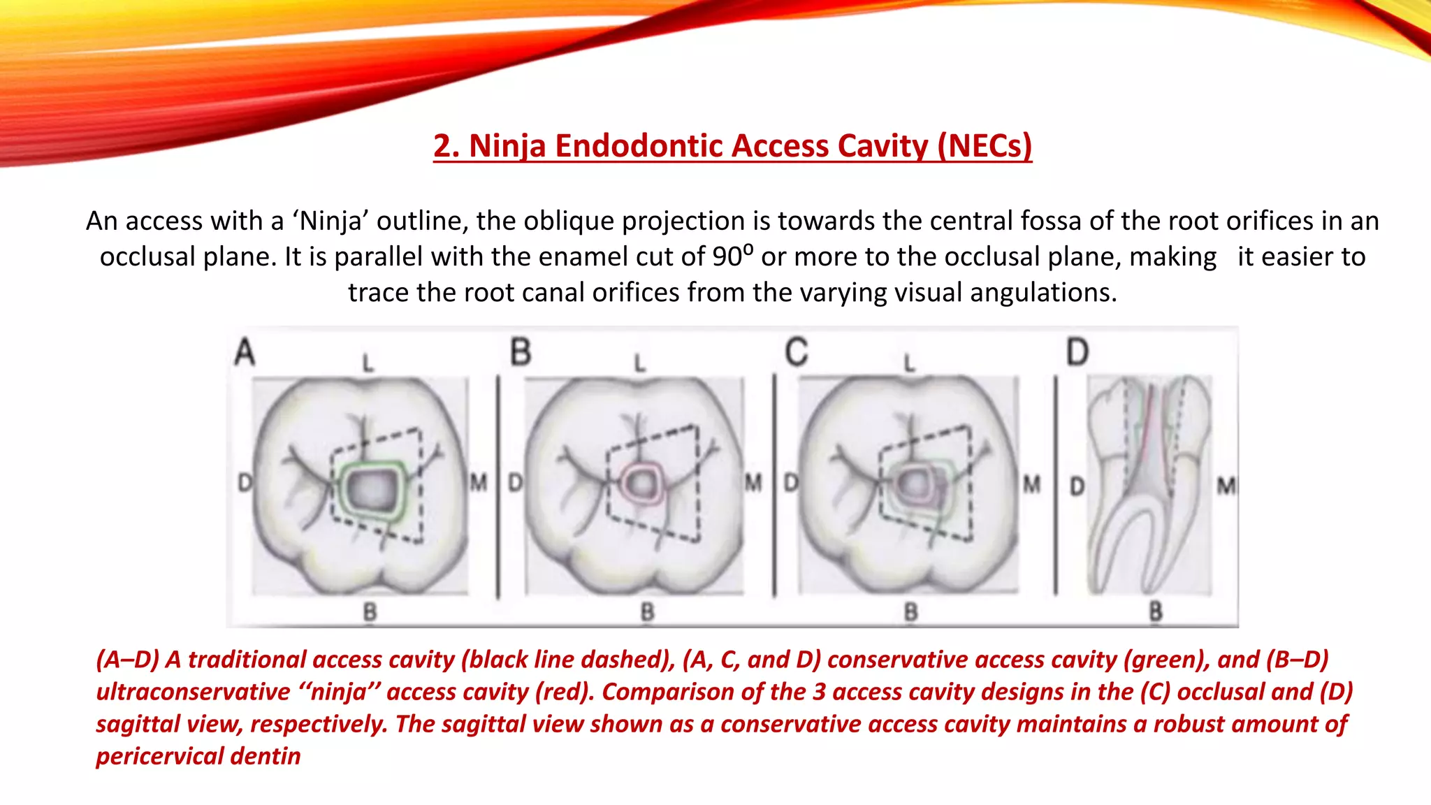 Minimal Invasive Endodontics | PPTX