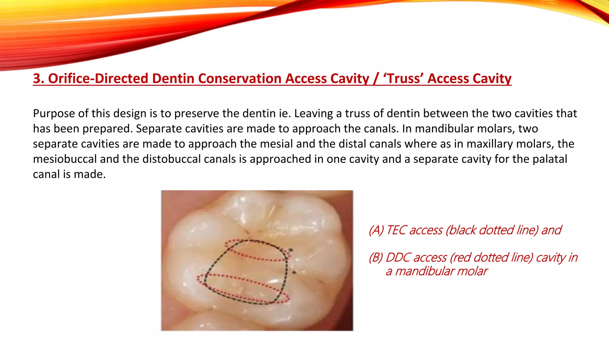 Minimal Invasive Endodontics | PPTX