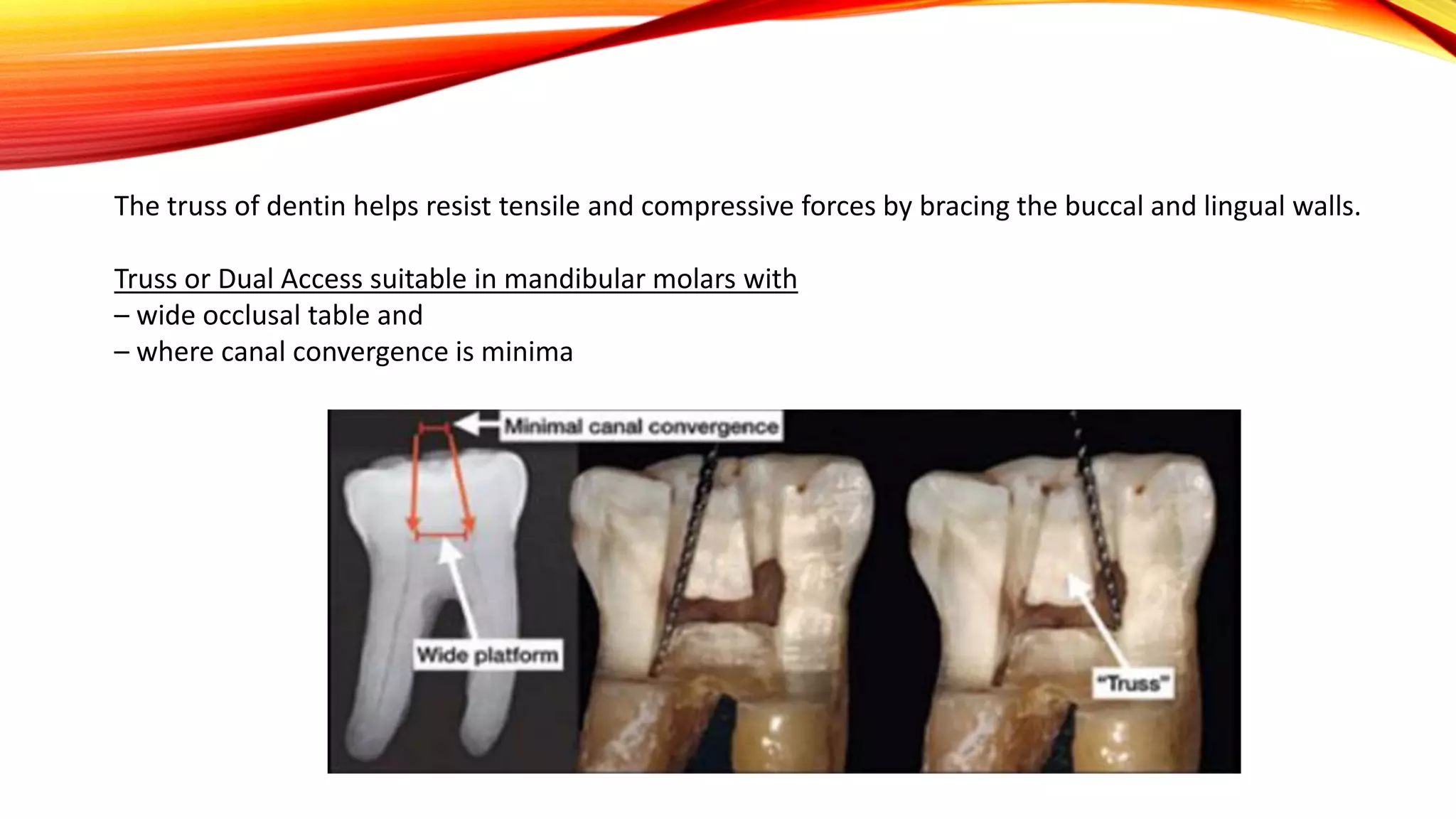 Minimal Invasive Endodontics | PPTX