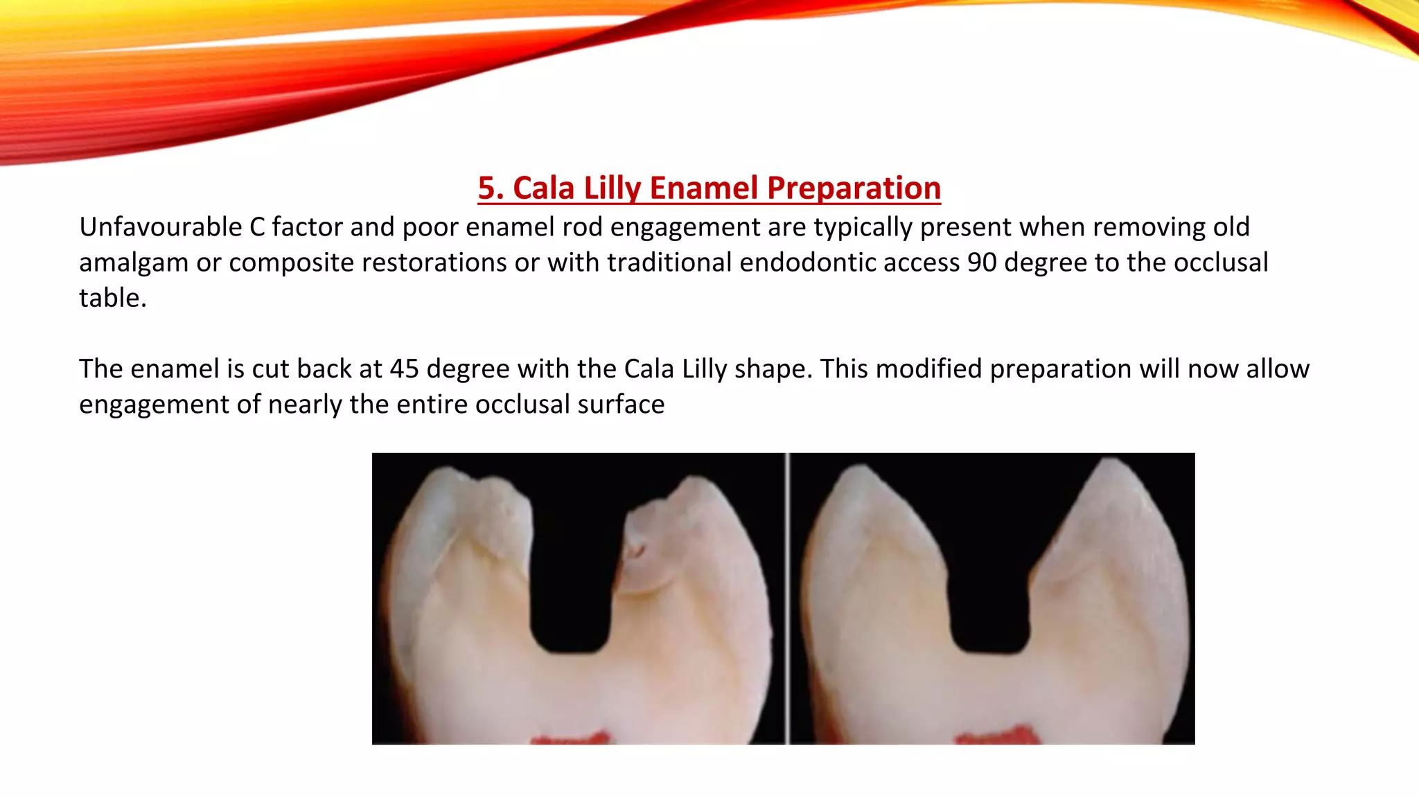Minimal Invasive Endodontics | PPTX