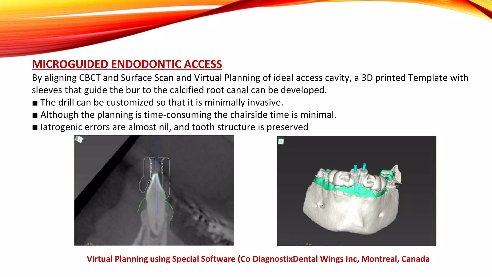 Minimal Invasive Endodontics | PPTX