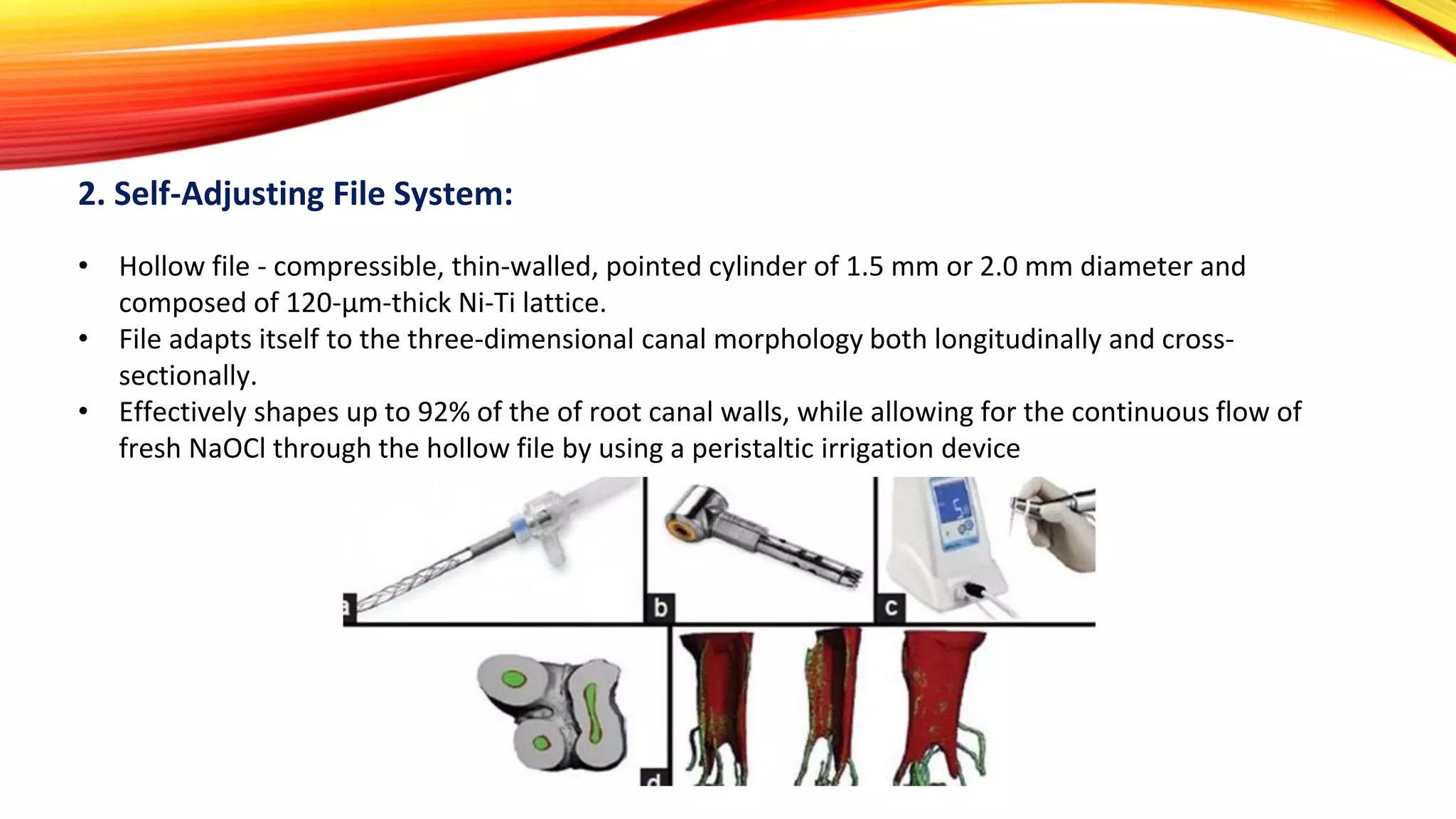 Minimal Invasive Endodontics | PPTX