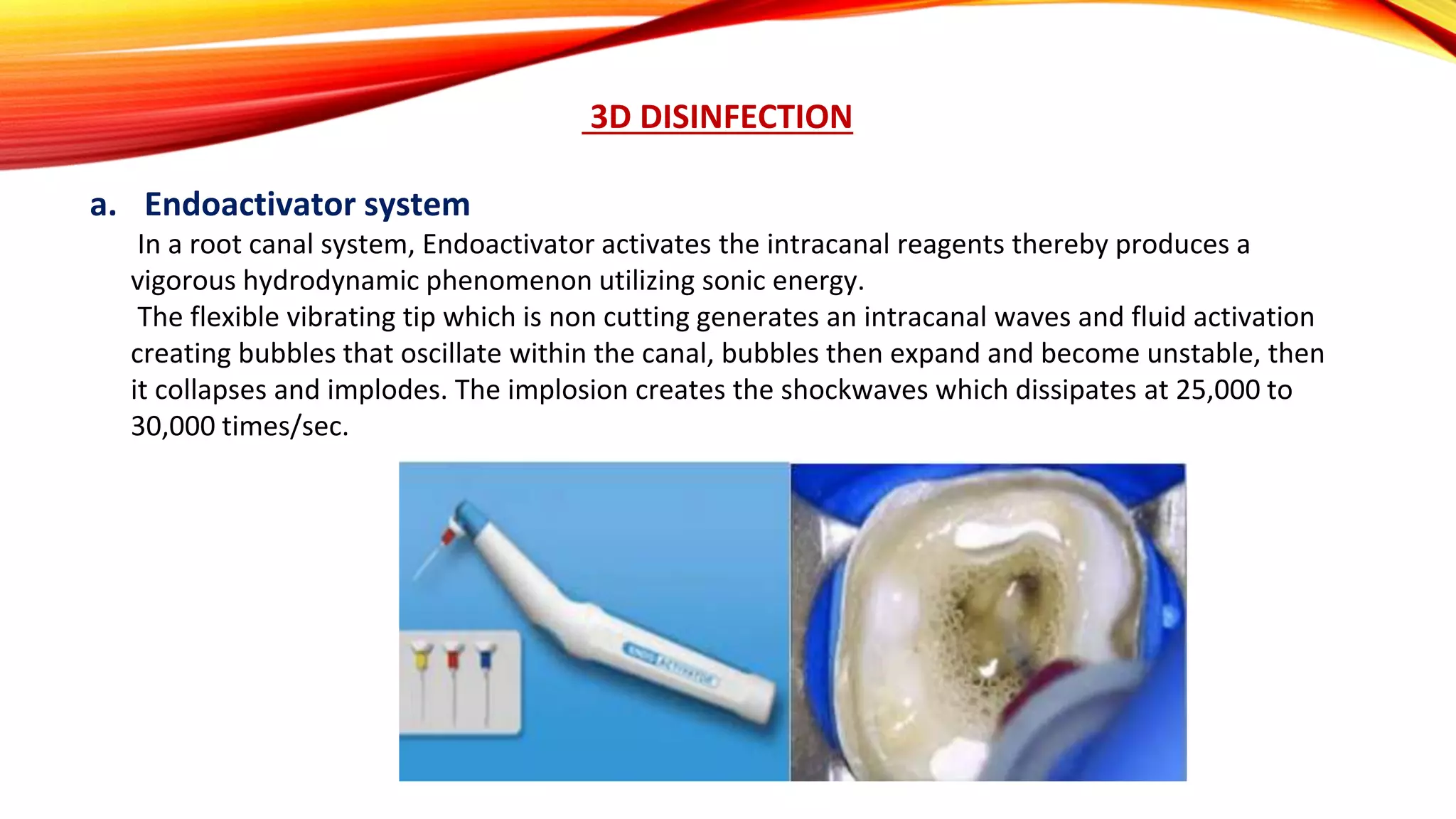 Minimal Invasive Endodontics | PPTX