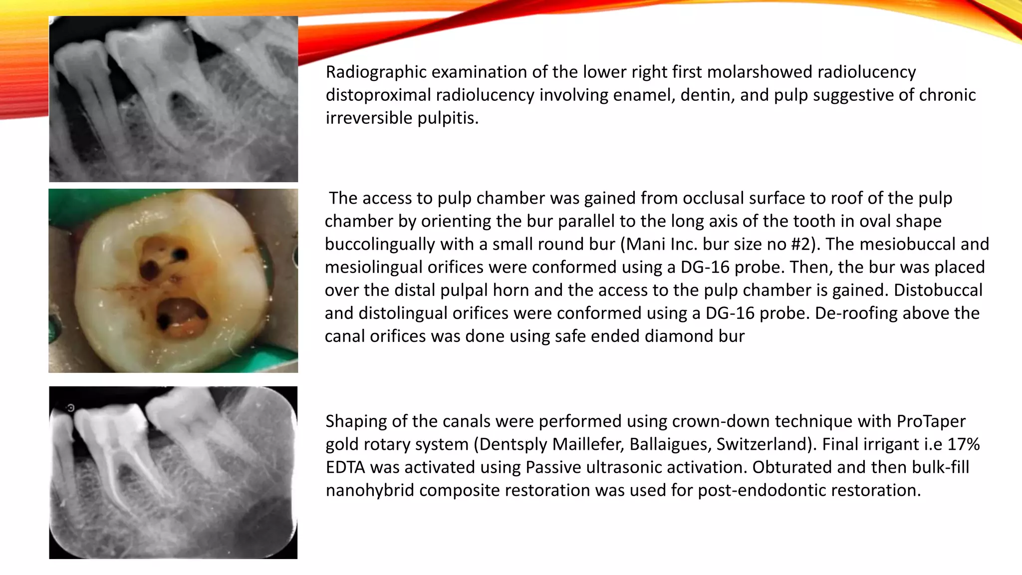 Minimal Invasive Endodontics | PPTX