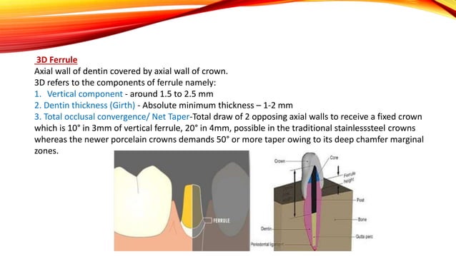 Minimal Invasive Endodontics | PPTX