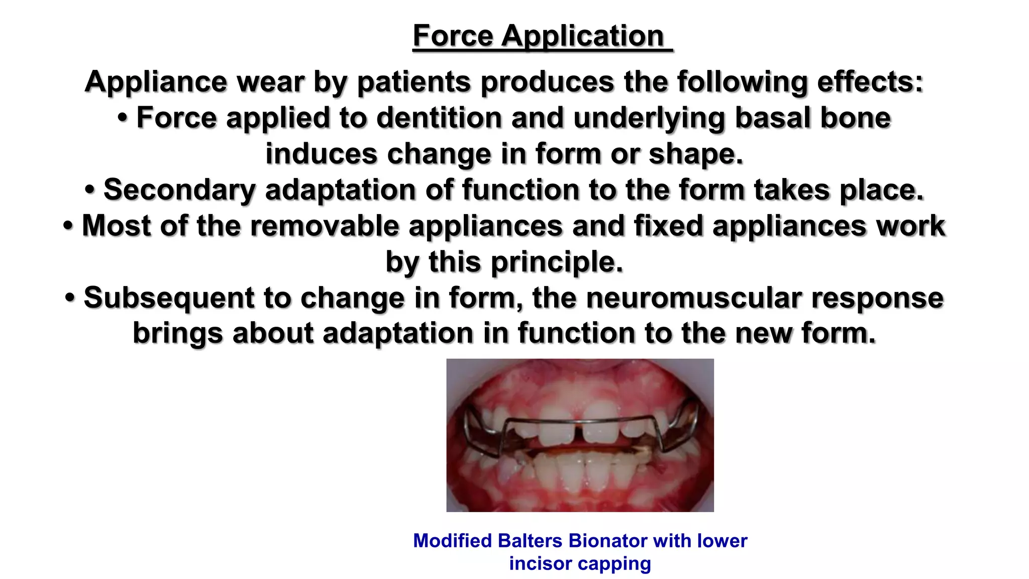 removable functional appliance 1 | PPTX