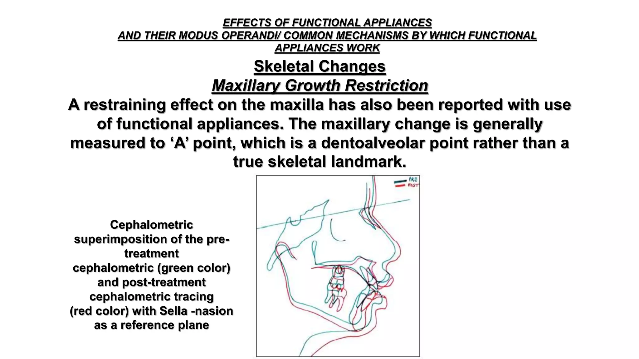 removable functional appliance 1 | PPTX