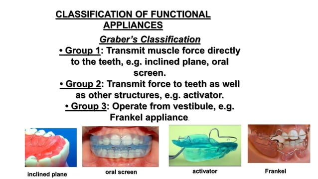 removable functional appliance 1 | PPTX