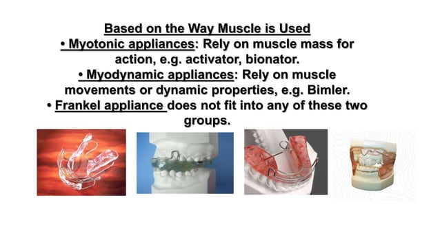 removable functional appliance 1 | PPTX
