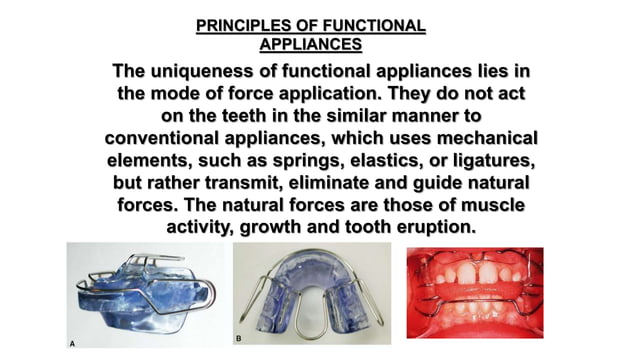 removable functional appliance 1 | PPTX