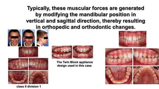 removable functional appliance 1 | PPTX