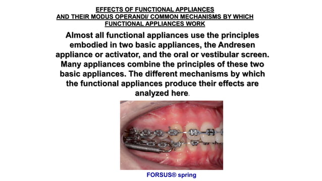 removable functional appliance 1 | PPTX