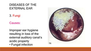 A STUDY ON COMMON EAR DISEASES | PPTX | Ear, Nose and Throat Conditions ...