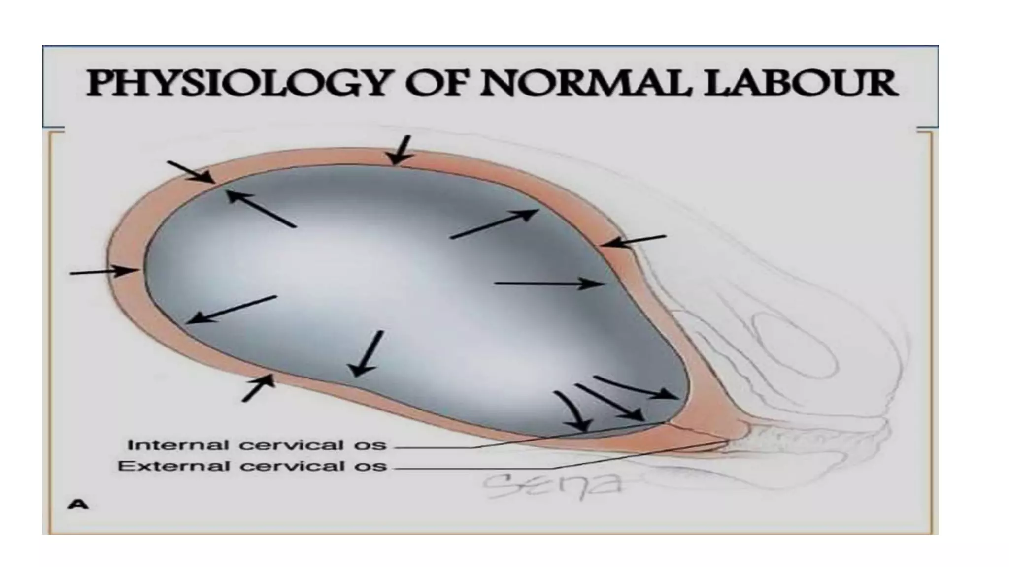 a detail study on normal labour ( definition, stages of labour ...