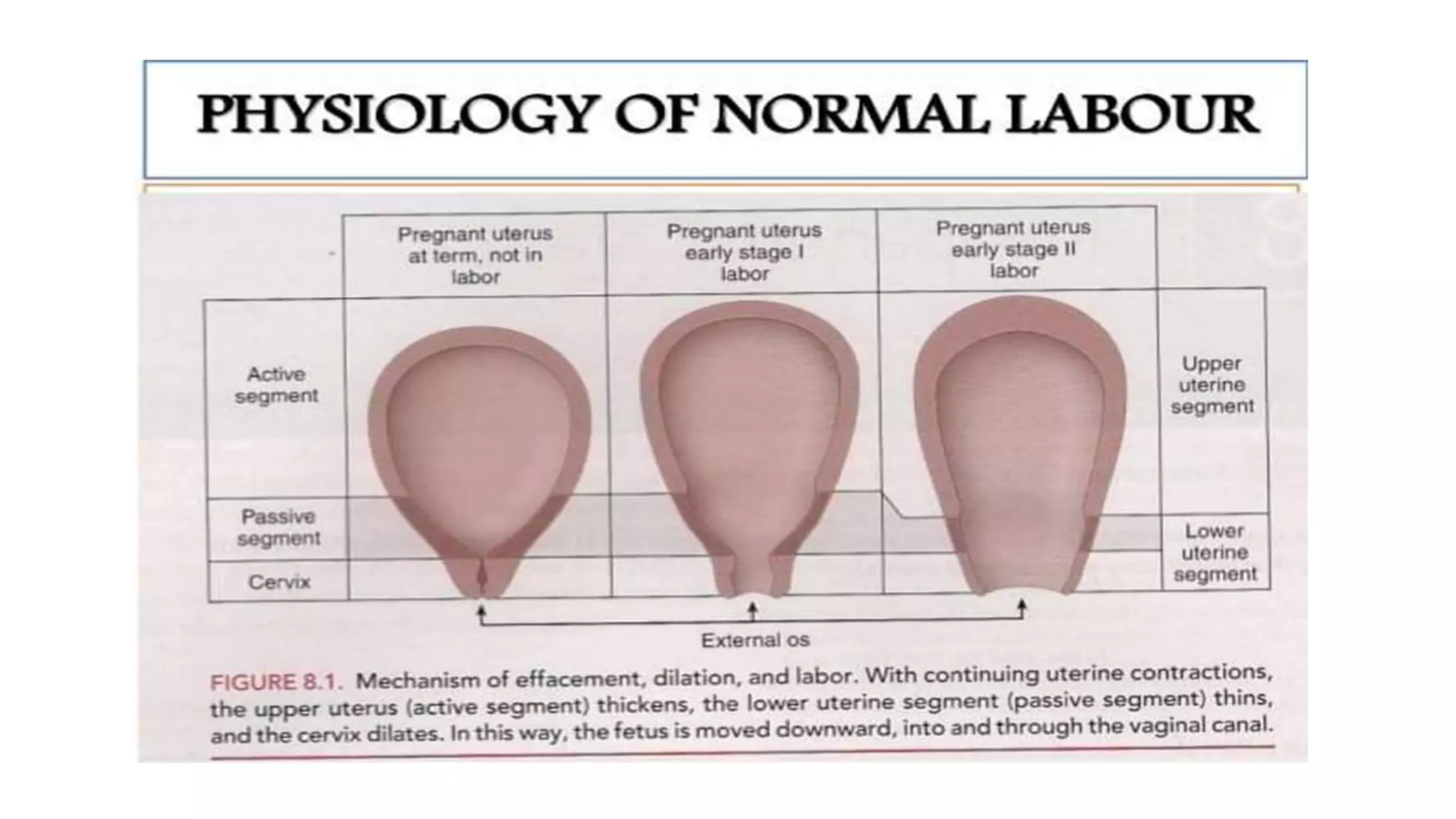 a detail study on normal labour ( definition, stages of labour ...