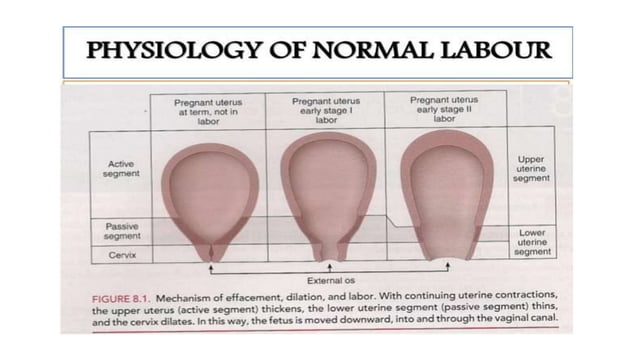 a detail study on normal labour ( definition, stages of labour ...